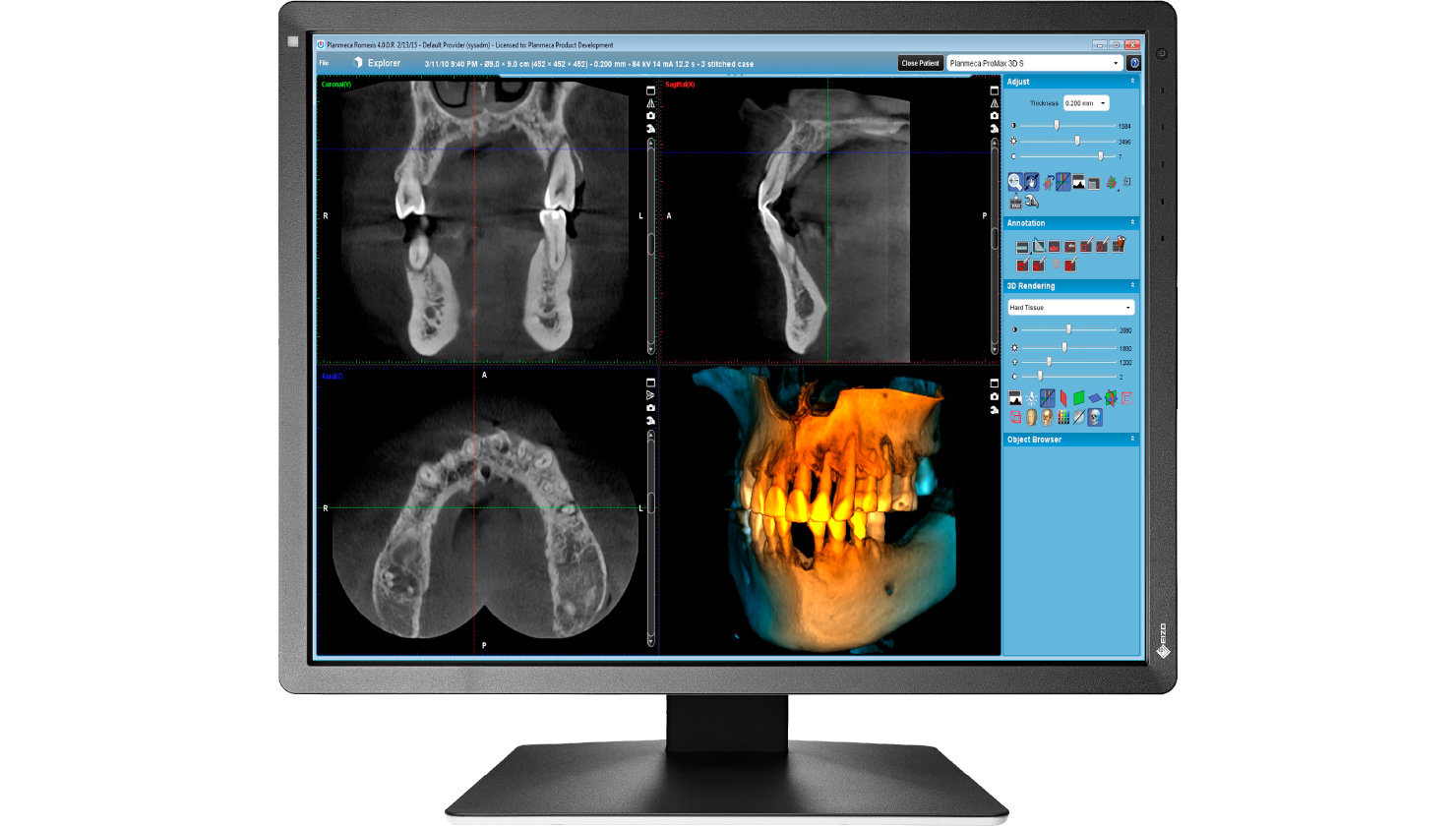 Monitor RadiForce - NESH Club 33 Informatica